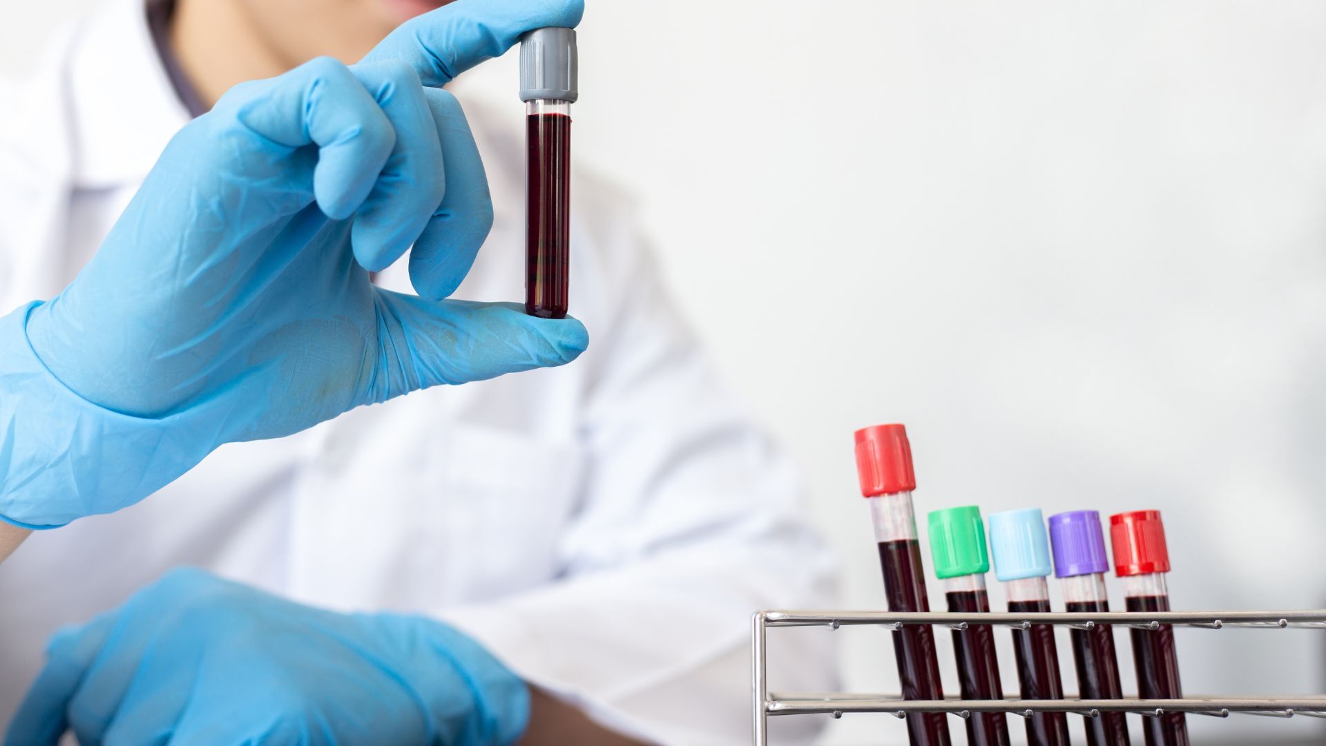 Unexpected Lab Findings Prompt Patients To Undergo Retests